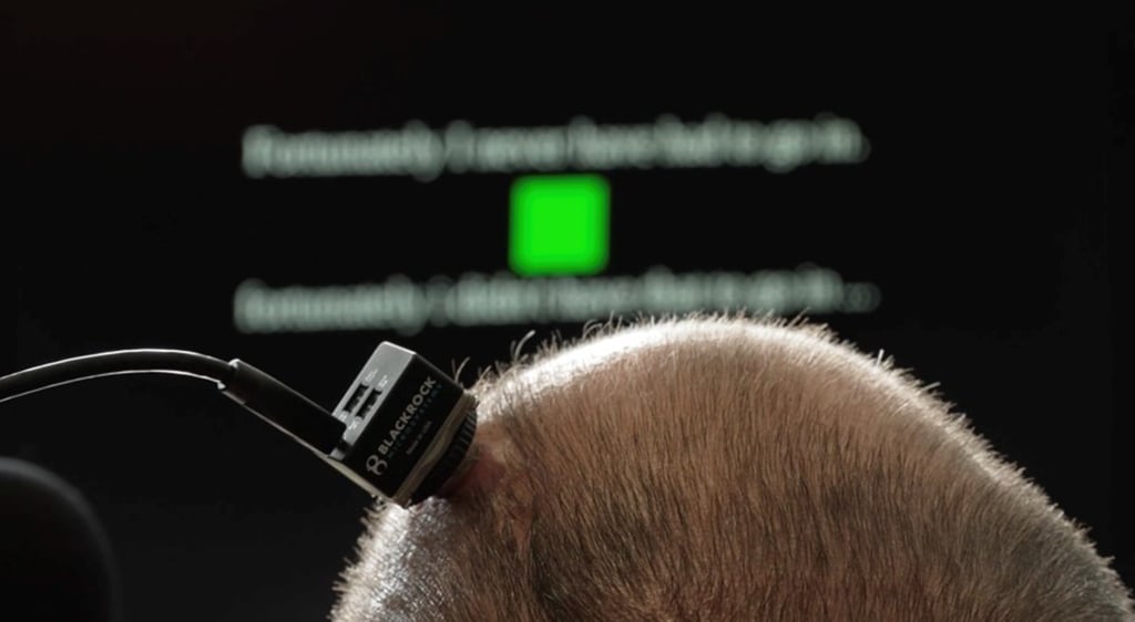 Brain activity into speech translation | Cybernews